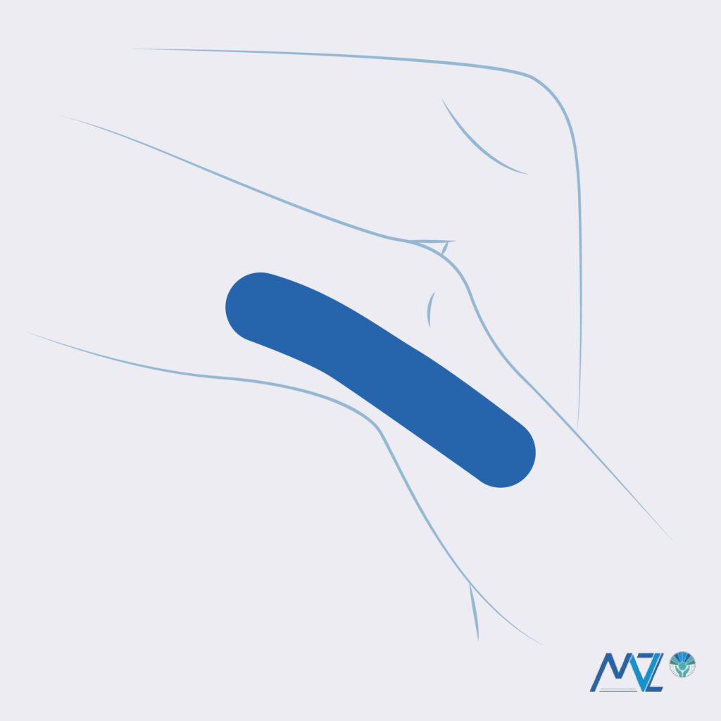 Knie tapen: Einfache Tipps vom Experten