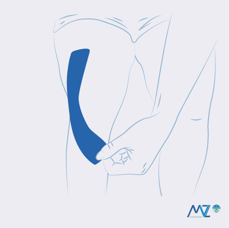 Knie tapen: Einfache Tipps vom Experten